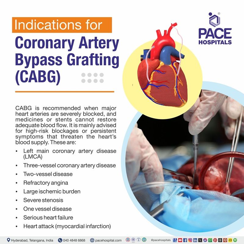 Best Hospital for Heart Bypass Surgery in Hyderabad, India