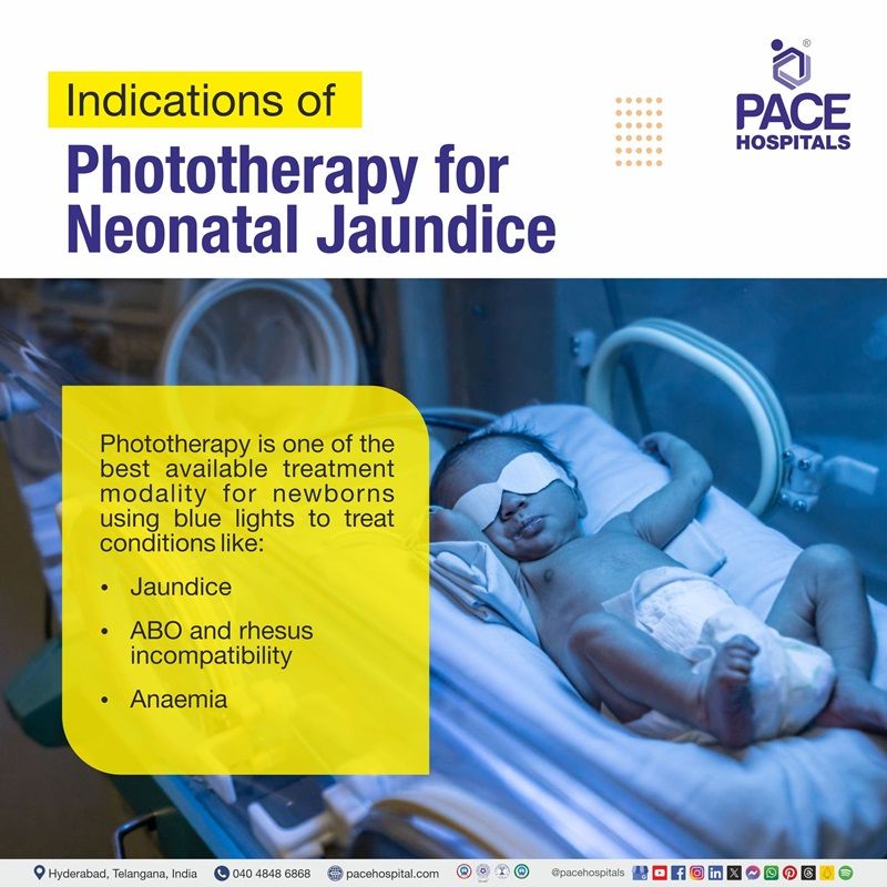 Phototherapy Treatment for Newborn Jaundice in Hyderabad, India