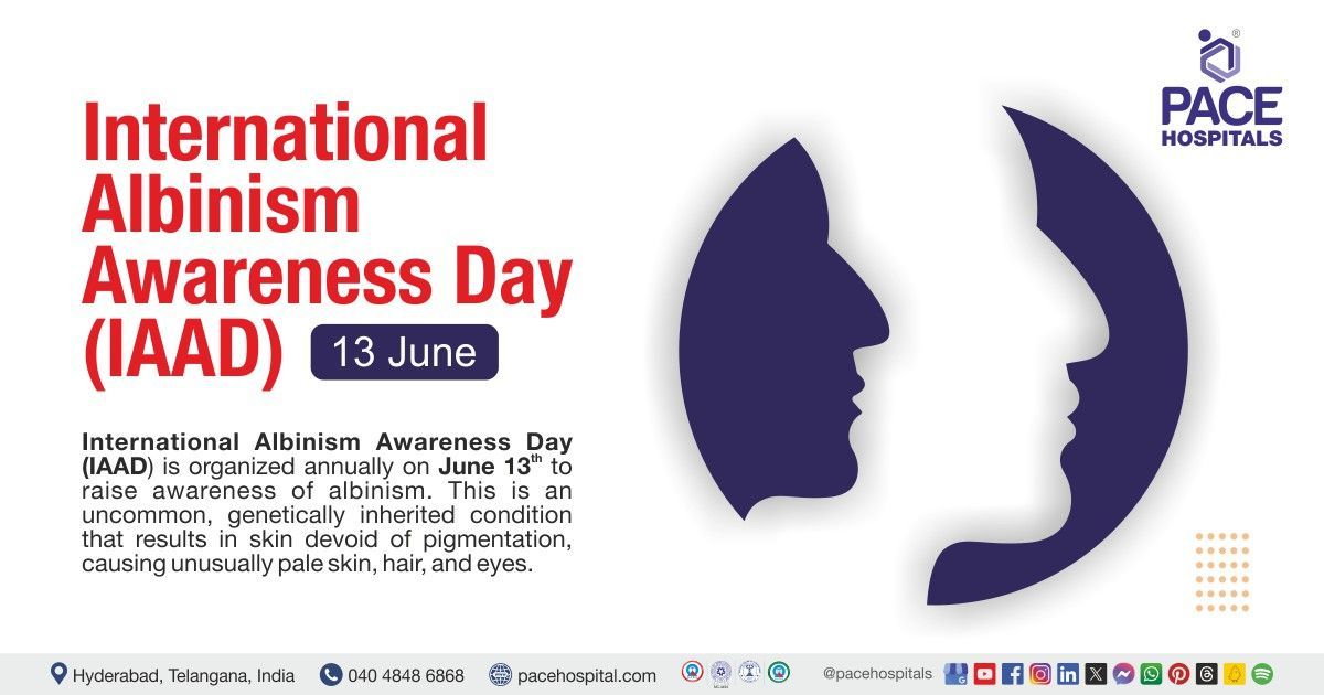 International Albinism Awareness Day 9 Important Facts About Albinism