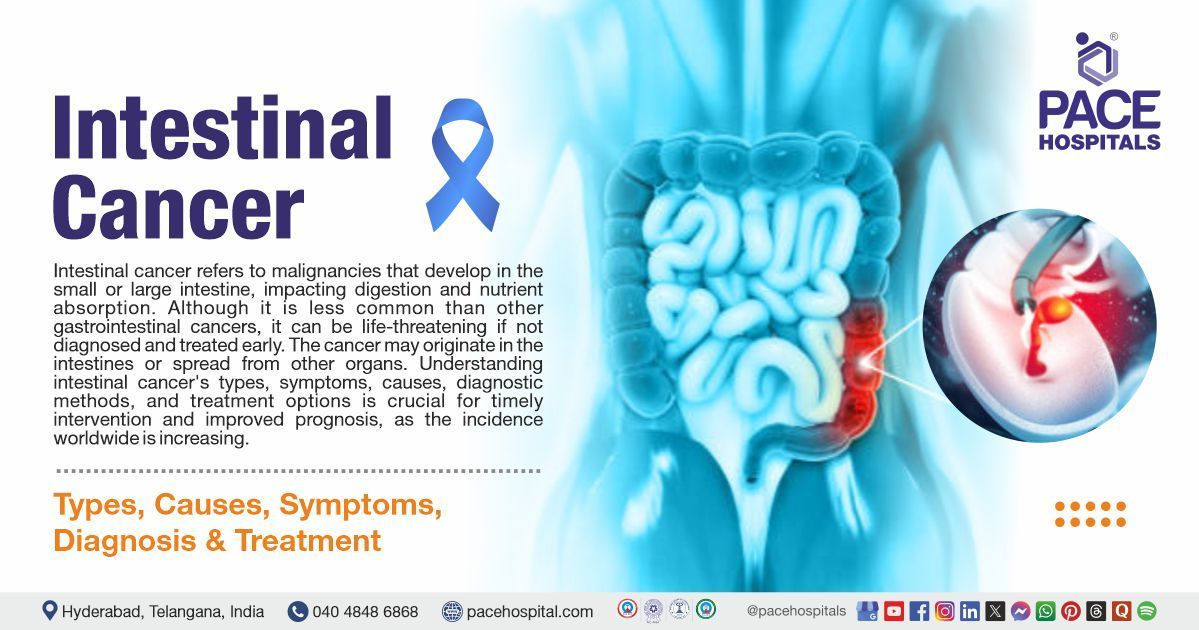 Intestinal Cancer: Symptoms, Causes, Diagnosis & Treatment