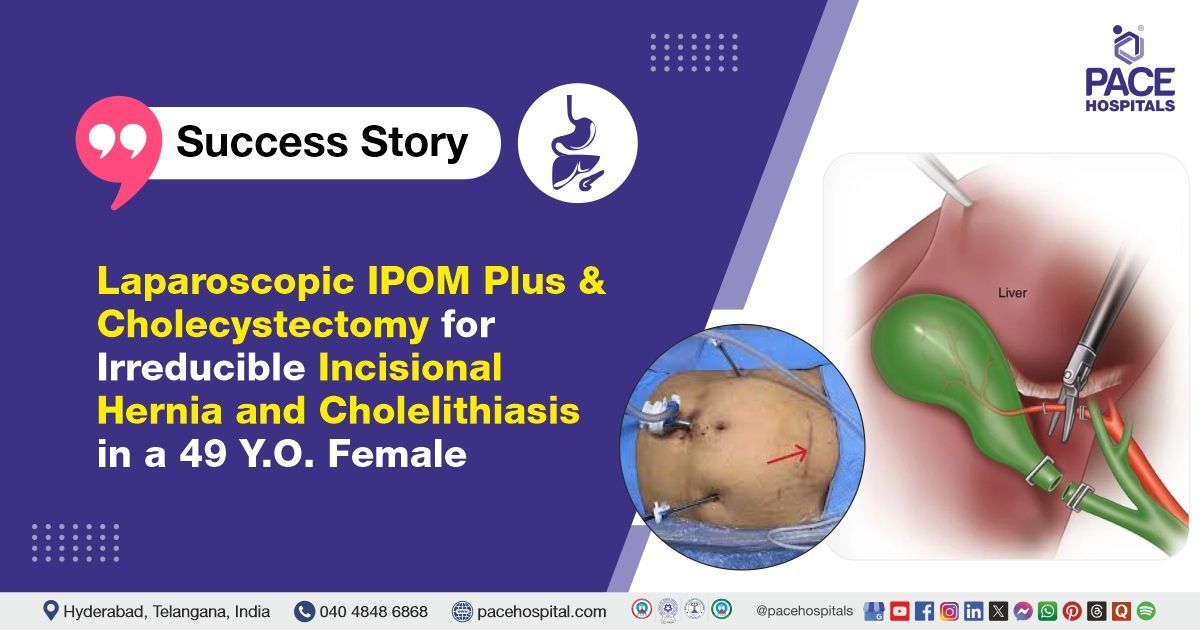 Lap. IPOM & Cholecystectomy for Irreducible Hernia & Gallstones