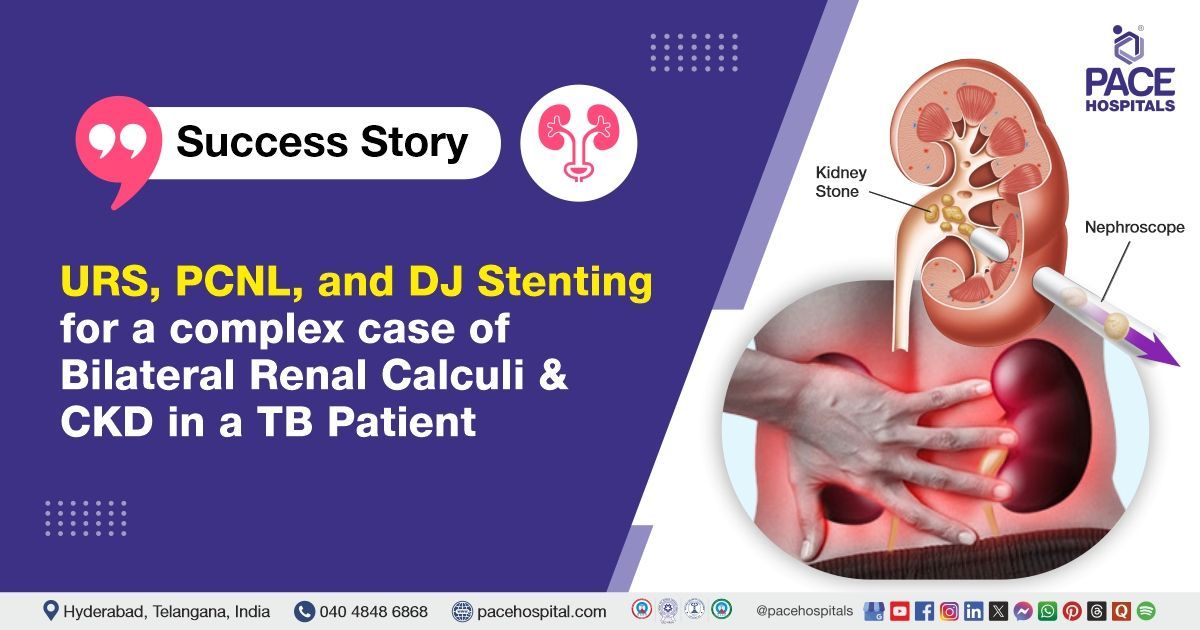 Bilateral Kidney Stone removal Surgery with URS, PCNL & DJ Stent