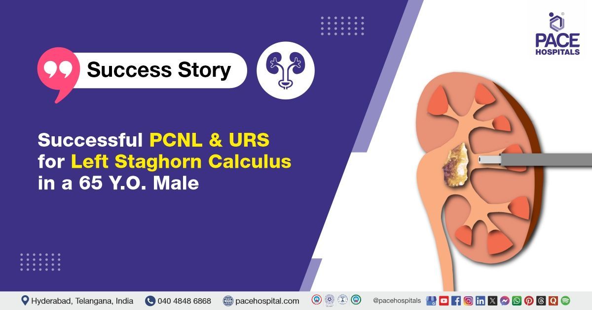 Right Kidney Staghorn Stone Pcnl