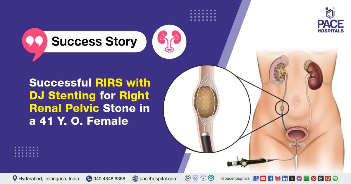 Kidney Stone Treatment with RIRS Surgery & DJ Stenting