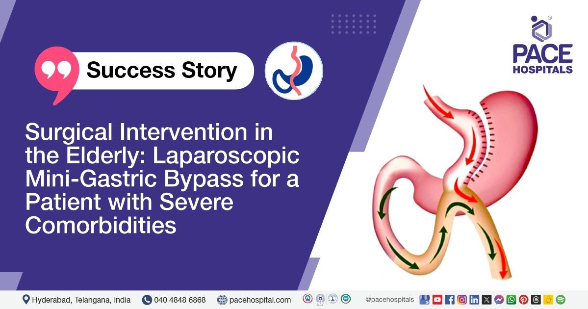 Successful Laparoscopic Mini-Gastric Bypass for Severe Obesity