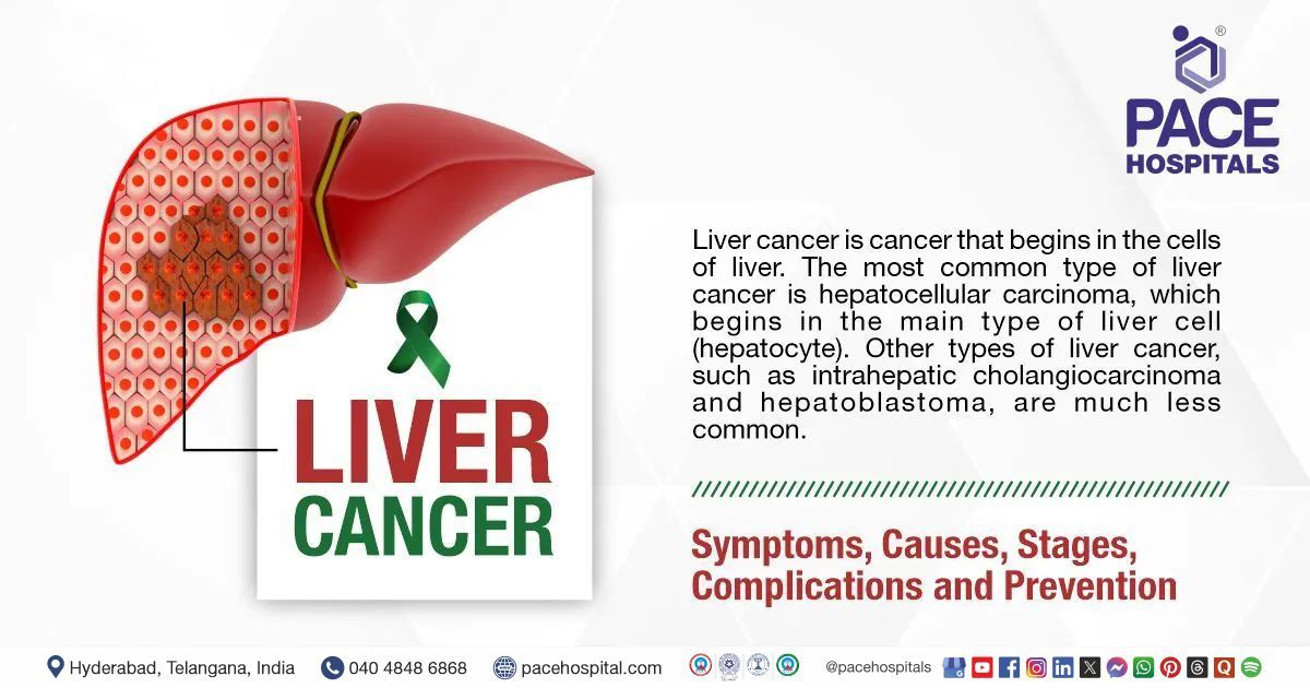 Liver Cancer - Symptoms, Causes, Types, Complications, Prevention