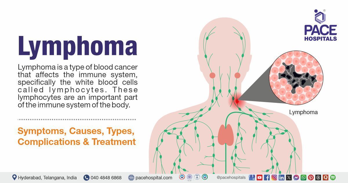 what are the 2 types of lymph node cancer