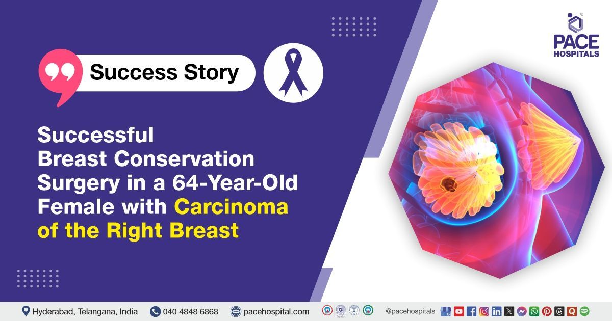 Successful Breast Cancer Treatment with Quadrantectomy in a 64YO