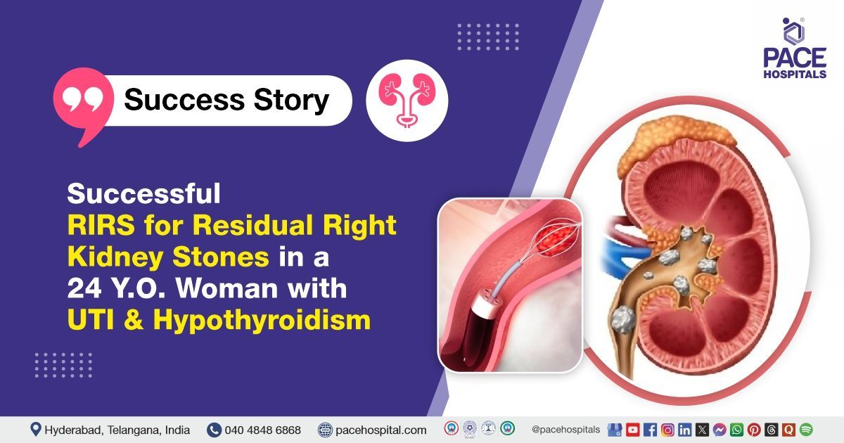 RIRS for Right Kidney Stone Removal in 24 Y.O Female with UTI