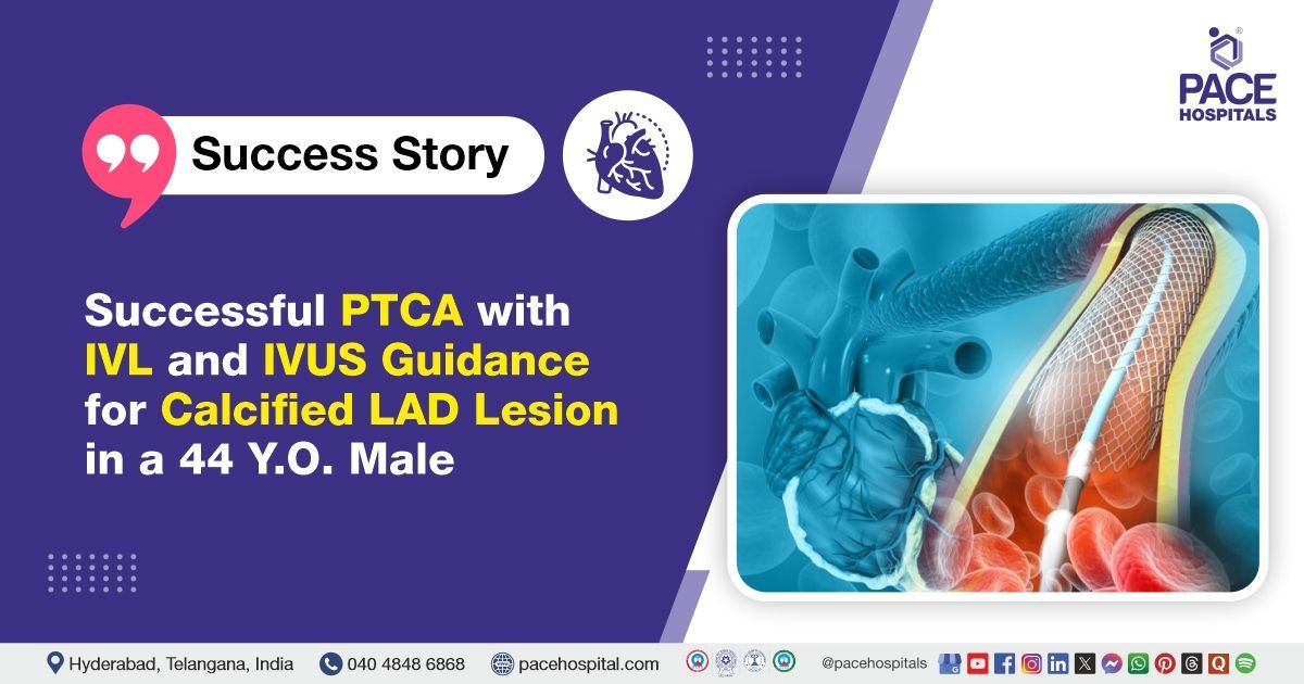 Calcified LAD Lesion treated with PTCA Using IVL & IVUS