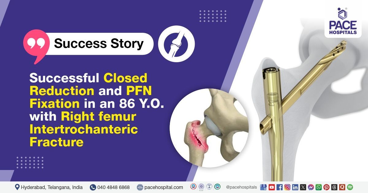 Right Femur Fracture treated with Closed Reduction & PFN Fixation