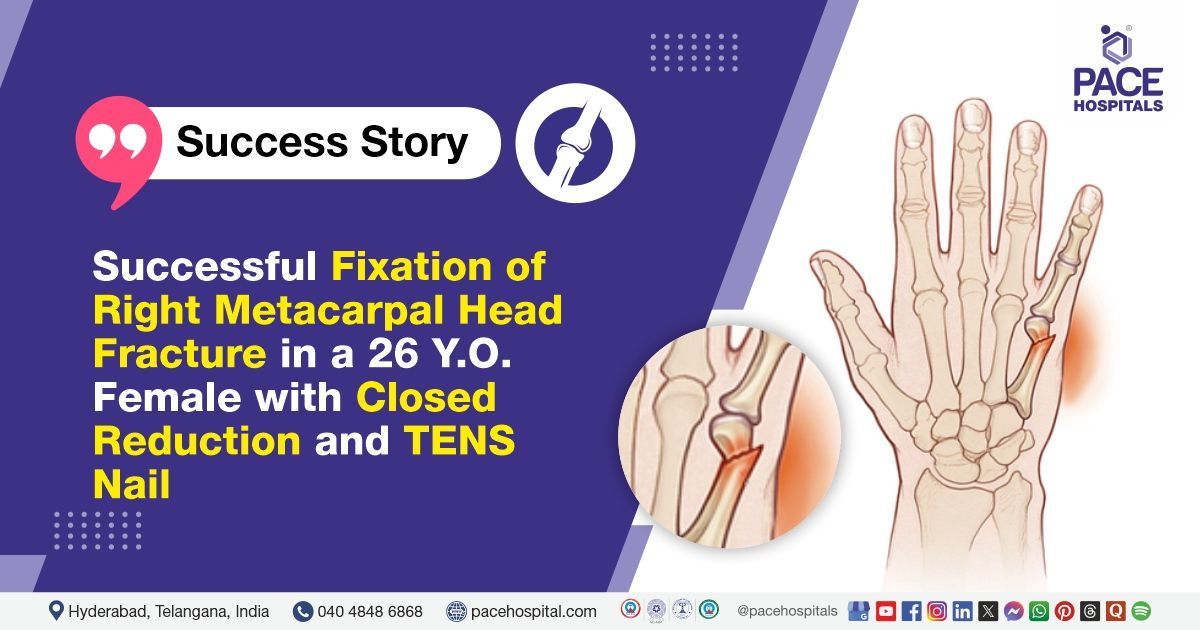 Metacarpal Head Injury treated with TENS Nail & Closed Reduction