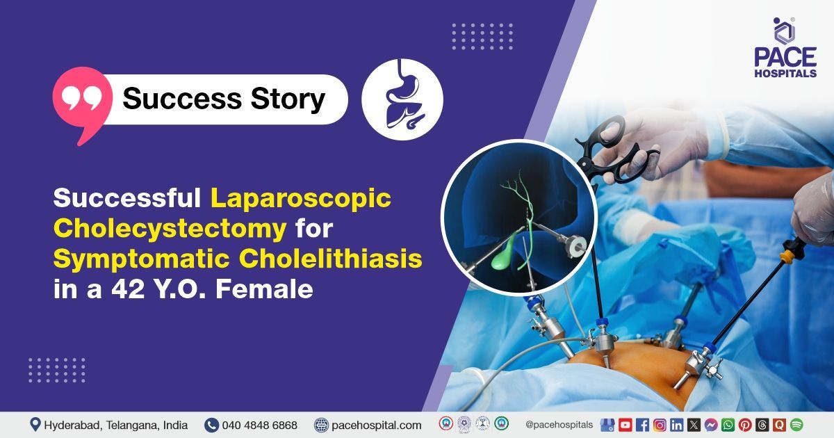 Symptomatic Cholelithiasis Treated with Lap. Cholecystectomy
