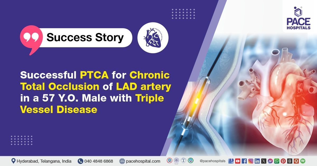 PTCA treated CTO of LAD Artery in Triple Vessel Disease