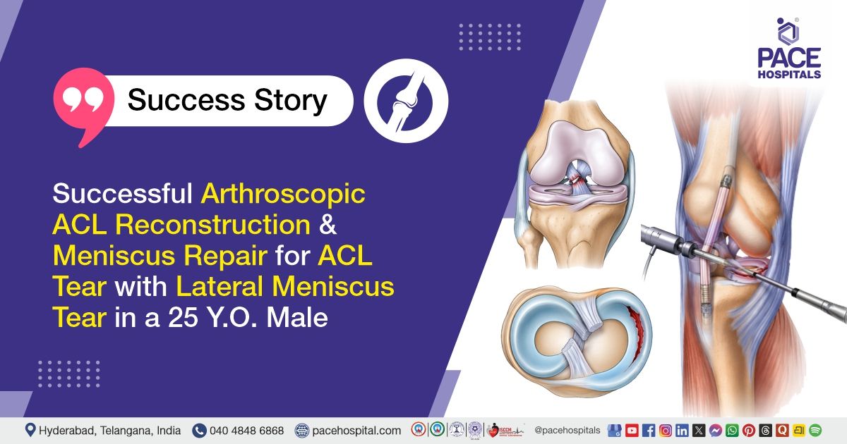 ACL Reconstruction and Meniscus Repair for ACL Tear