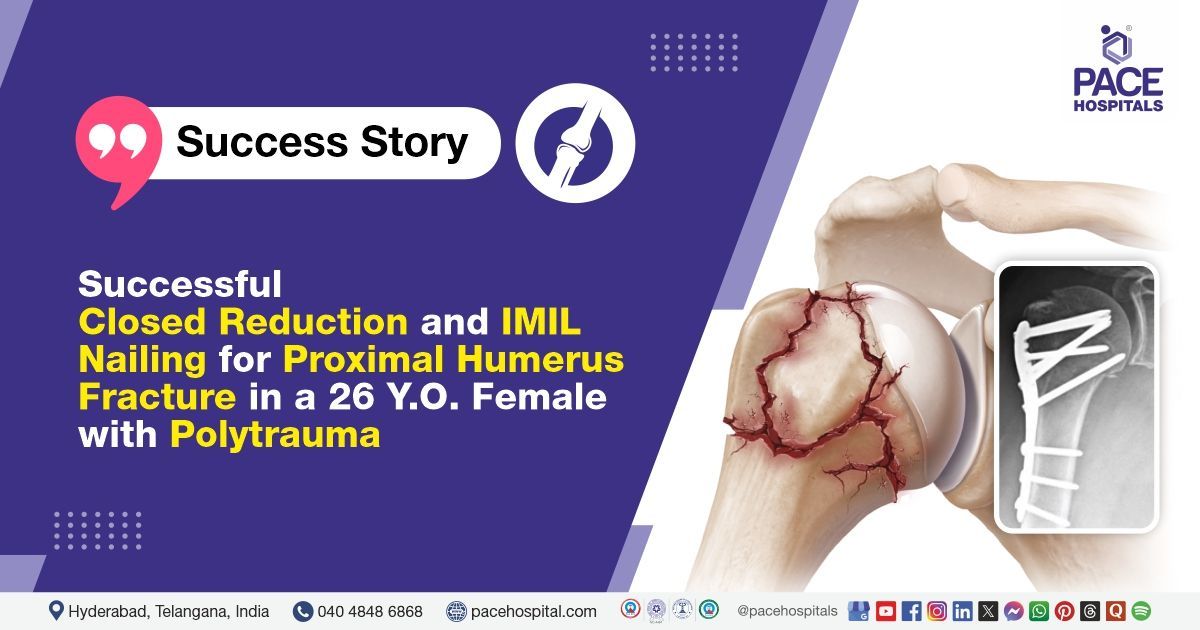 Closed Reduction & IMIL Nailing for Proximal Humerus Fracture