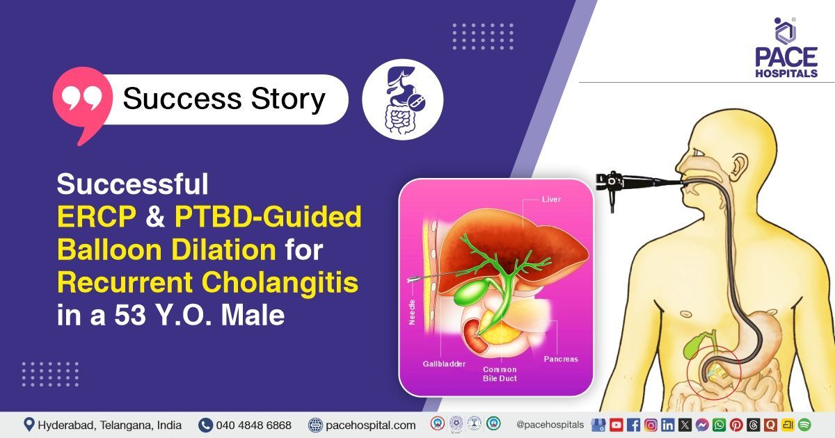 ERCP & PTBD-Guided Balloon Dilation for Recurrent Cholangitis