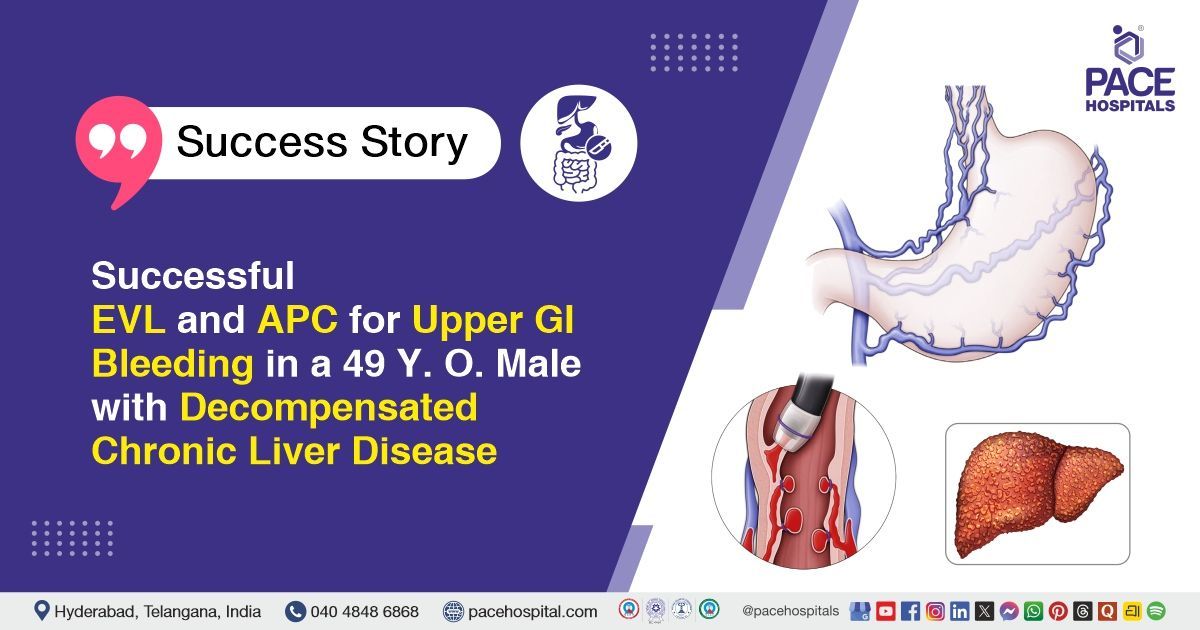 EVL and APC for Esophageal Varices and Duodenal Ulcer