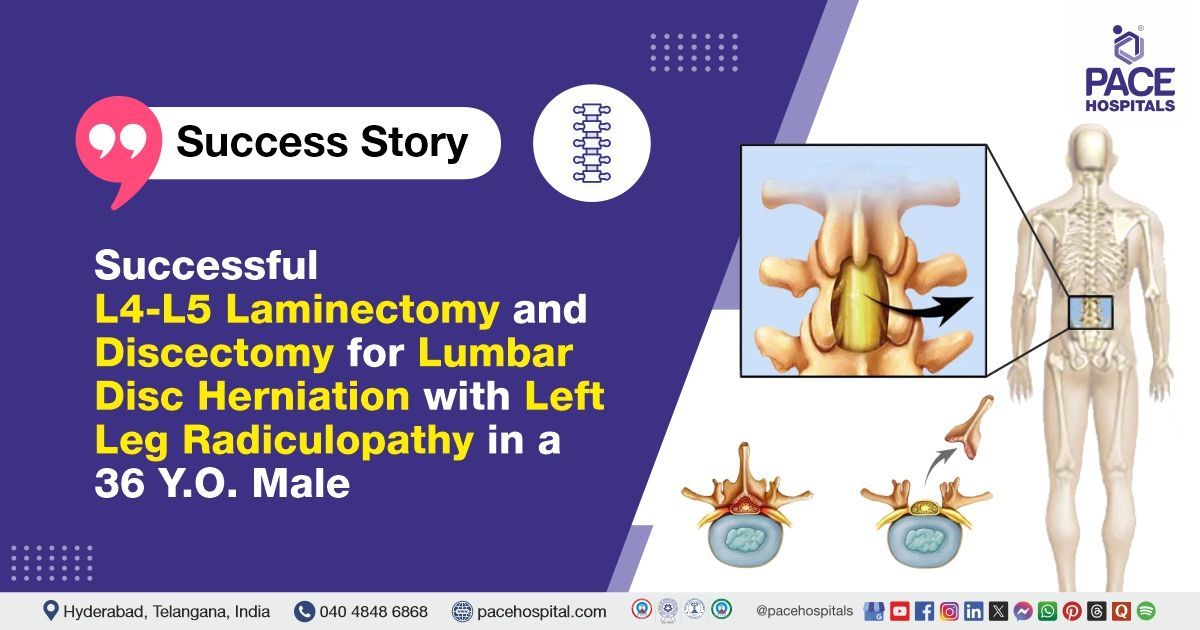 Lumbar Disc Herniation treated with Laminectomy & Discectomy