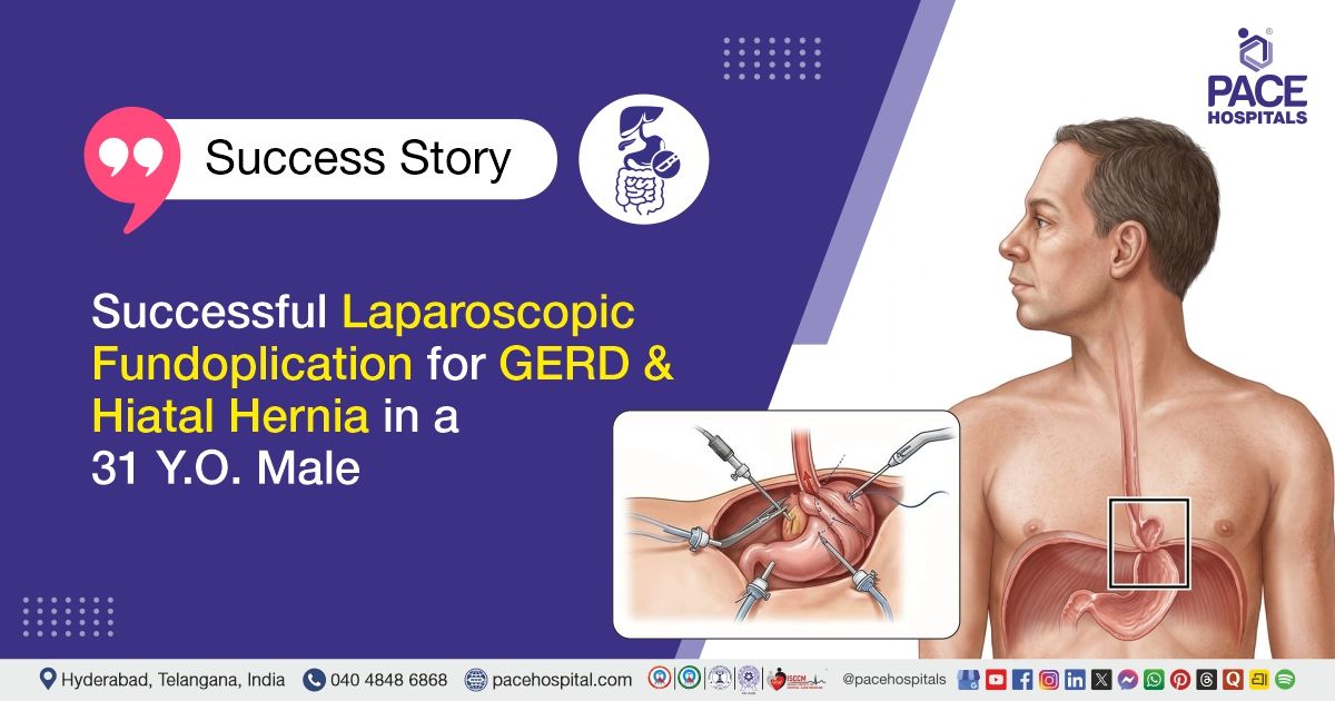 GERD Surgery Success | Fundoplication in 31 Y.O. Male
