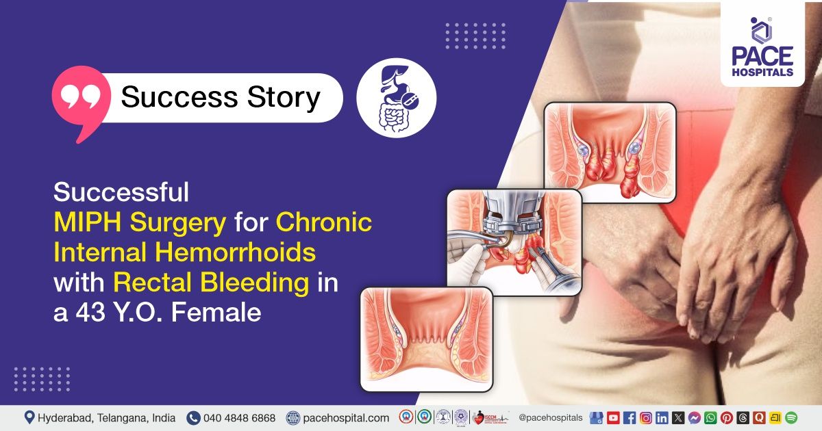 Successful MIPH Surgery for Internal Hemorrhoids in a 43 Y.O. Female