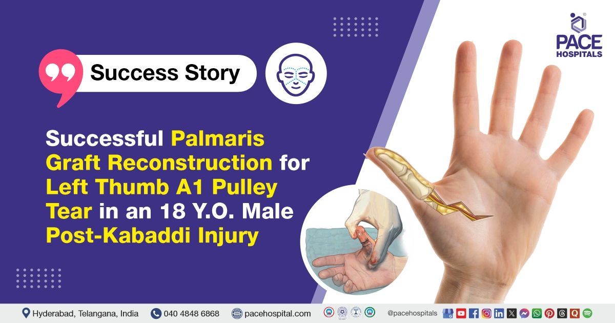 Palmaris Graft Reconstruction for Left Thumb A1 Pulley Tear