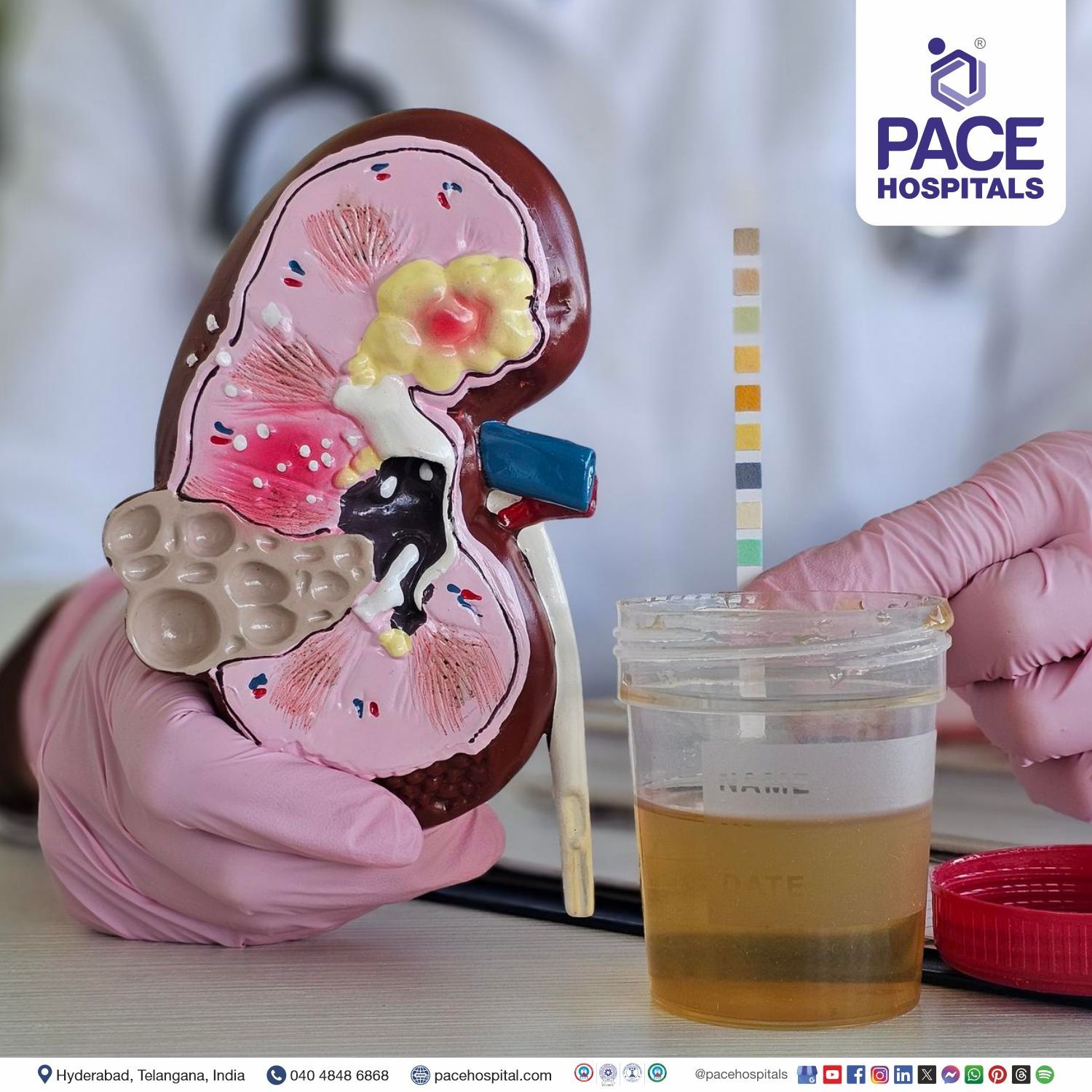 Best Nephrology Hospital in Hyderabad, Kidney Hospitals in India