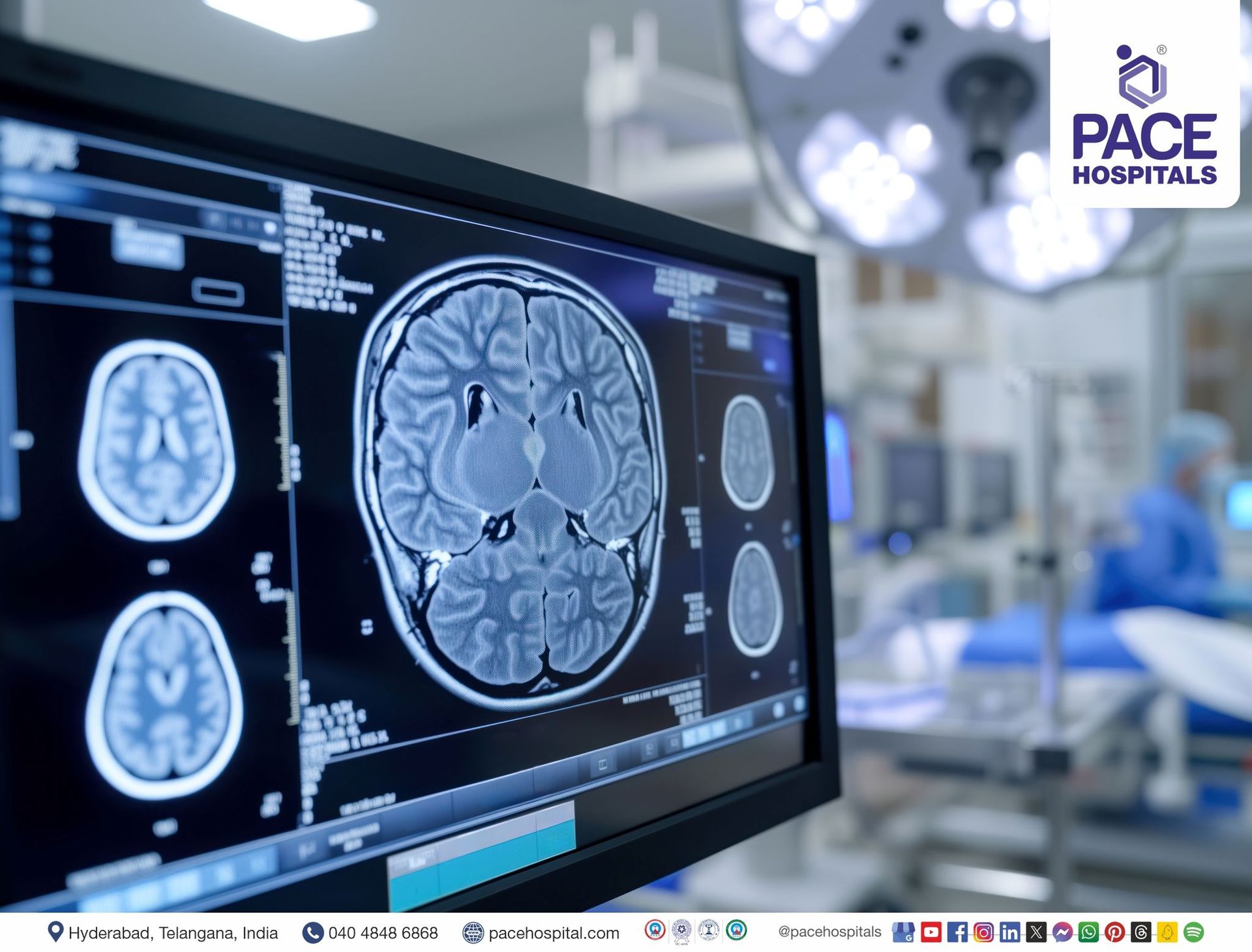 Best Neurology Hospital in Hyderabad for Neurological Disorders