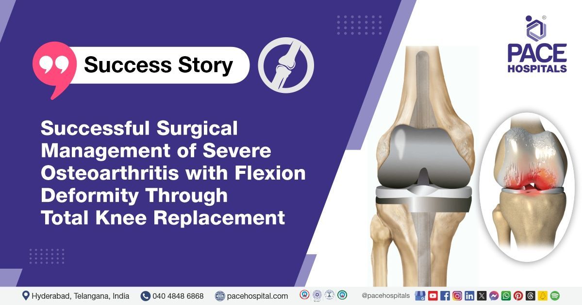Total Knee Replacement for Somalian Patient with Osteoarthritis