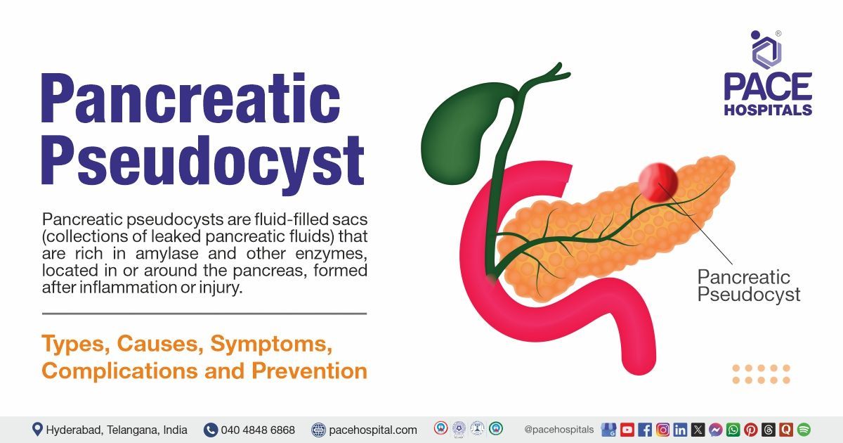 Pancreatic Pseudocyst: Symptoms, Causes, Treatment & Prevention