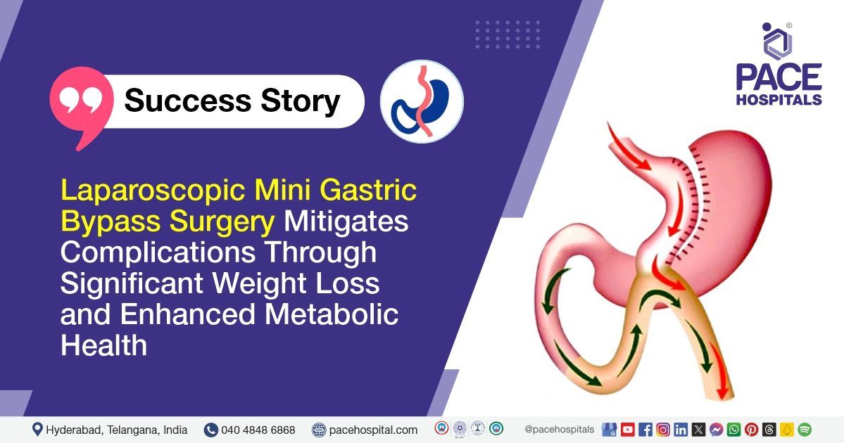 Effective Weight Loss Through Laparoscopic Mini Gastric Bypass
