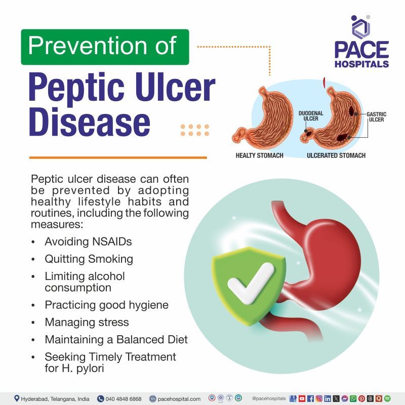 Peptic Ulcer - Types, Symptoms, Causes, Diagnosis & Treatment