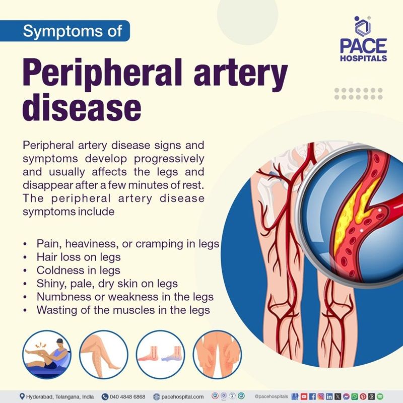 Peripheral Artery Disease (PAD) – Symptoms, Causes and Treatment