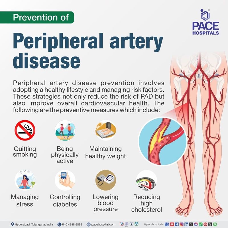 Peripheral Artery Disease (PAD) – Symptoms, Causes and Treatment