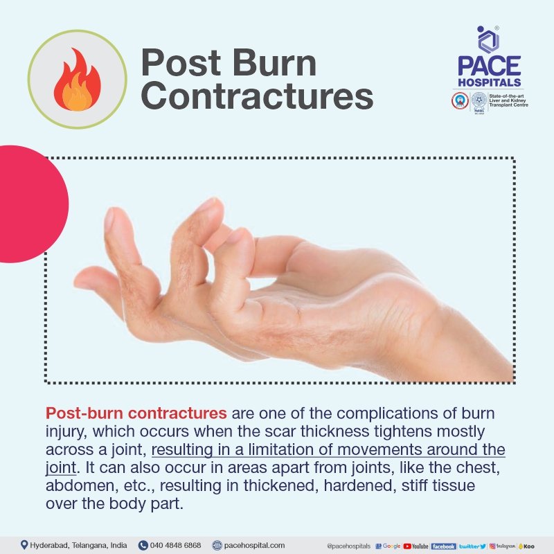 Best Hospital for Post Burn Contracture Treatment in Hyderabad