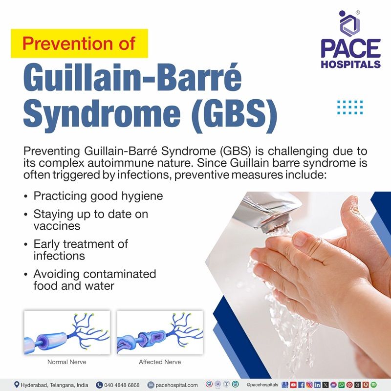 Guillain-Barré syndrome: Types, Symptoms, Causes & Treatment