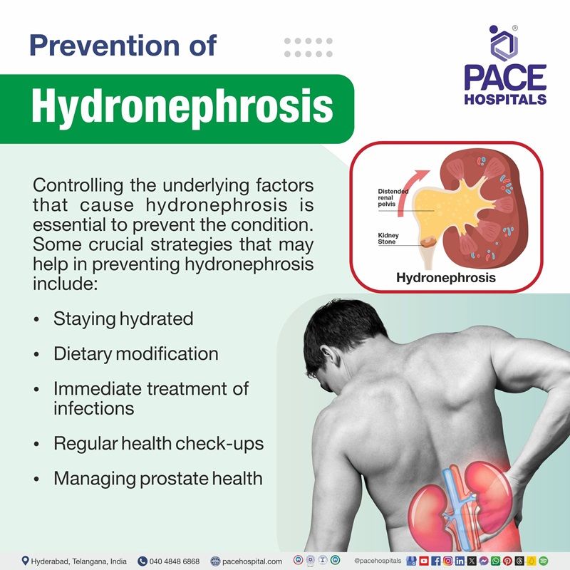 Hydronephrosis - Symptoms, Causes, Complications, Treatment