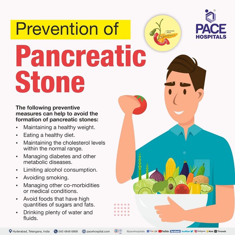 Pancreatic stones - Causes, Symptoms, Complications & Prevention
