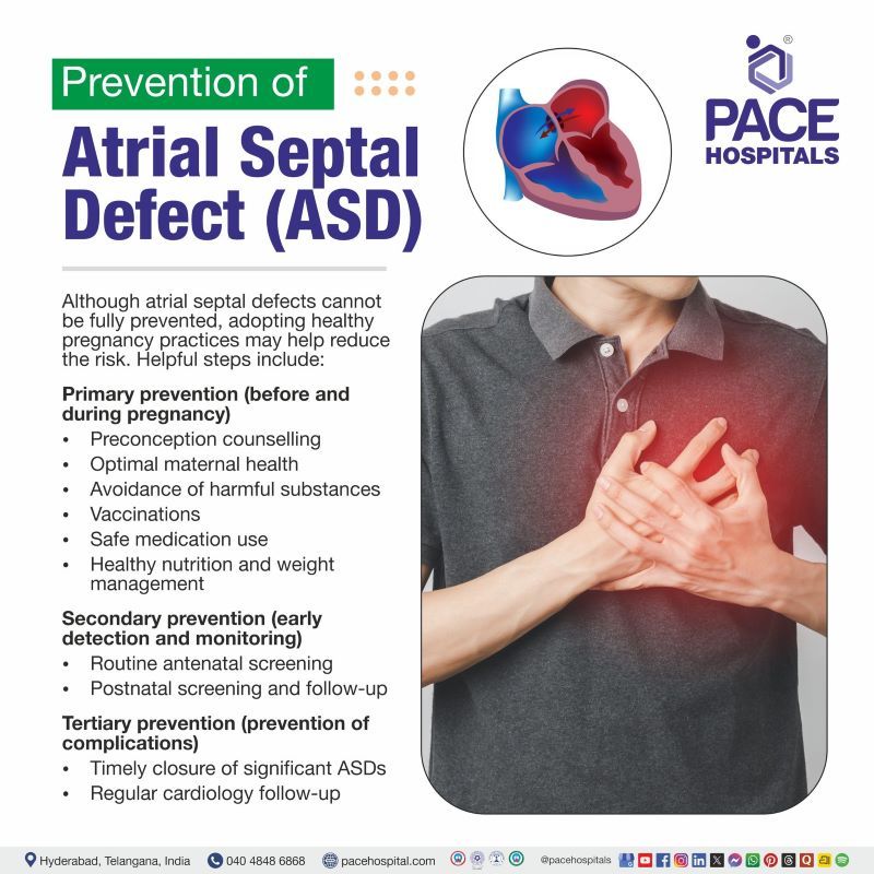 Atrial Septal Defect (ASD): Types, Symptoms, Causes & Treatment