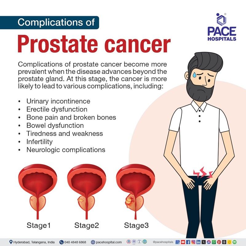 Prostate Cancer - Symptoms, Causes, Stages, Treatment, Prevention