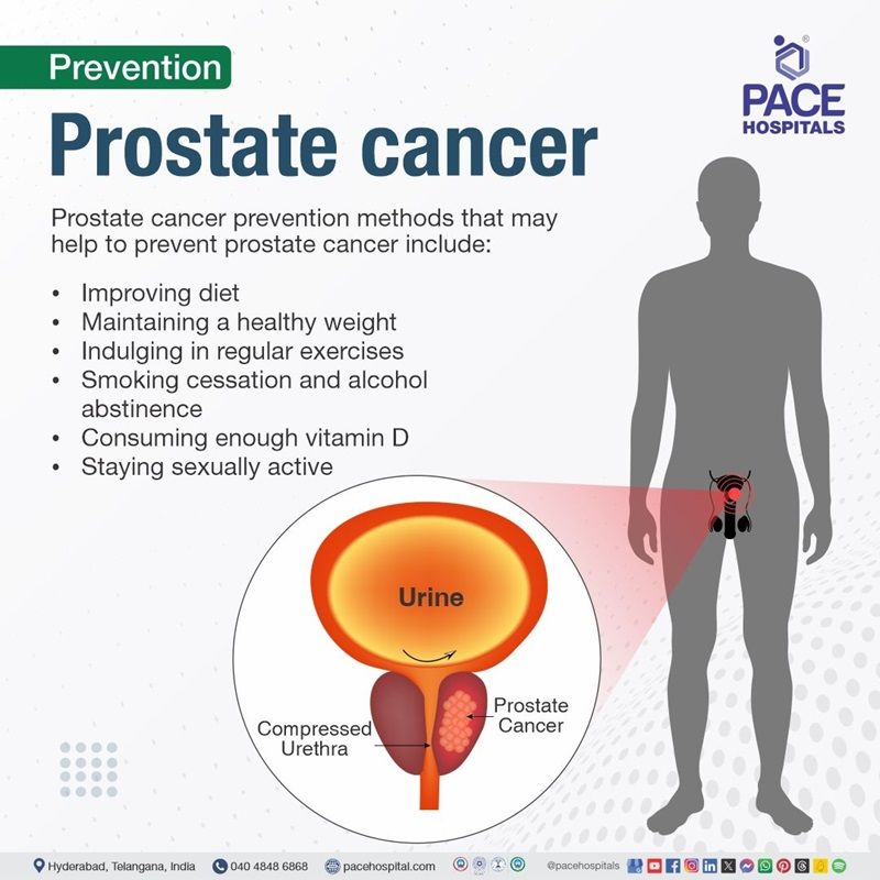 Prostate Cancer - Symptoms, Causes, Stages, Treatment, Prevention