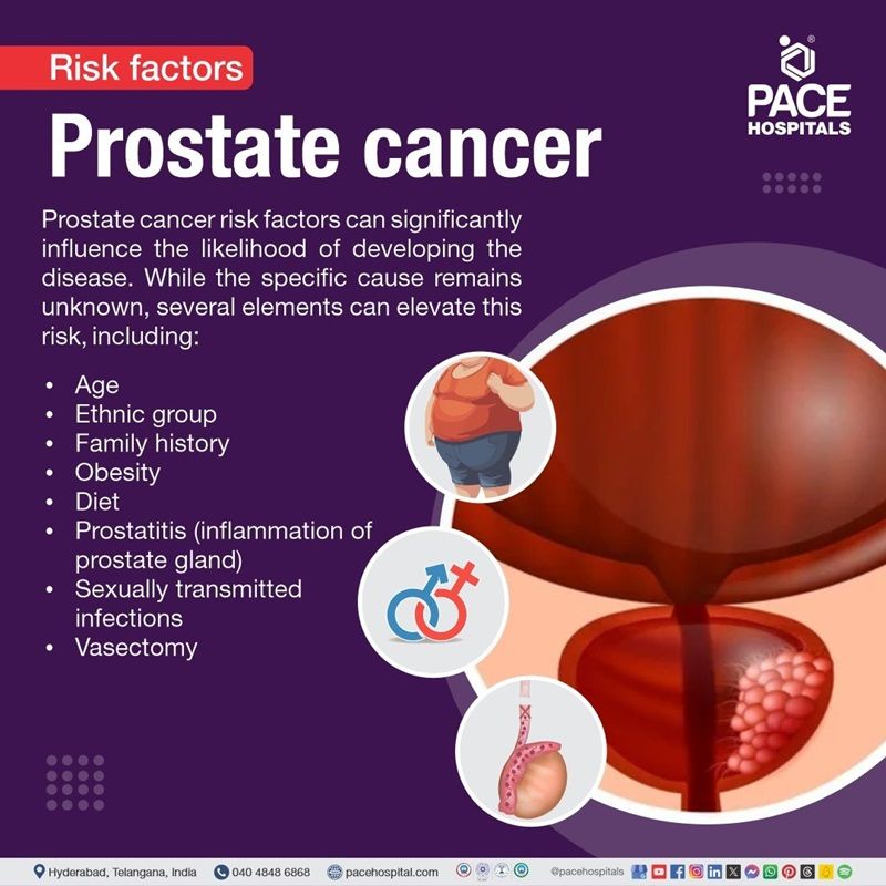 Prostate Cancer - Symptoms, Causes, Stages, Treatment, Prevention