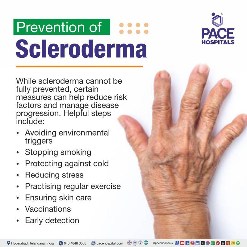 Scleroderma: Symptoms, Causes, Diagnosis & Treatment