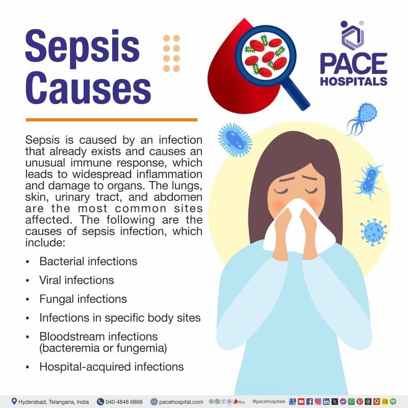 Sepsis: Symptoms, Causes, Diagnosis, Treatment & Prevention