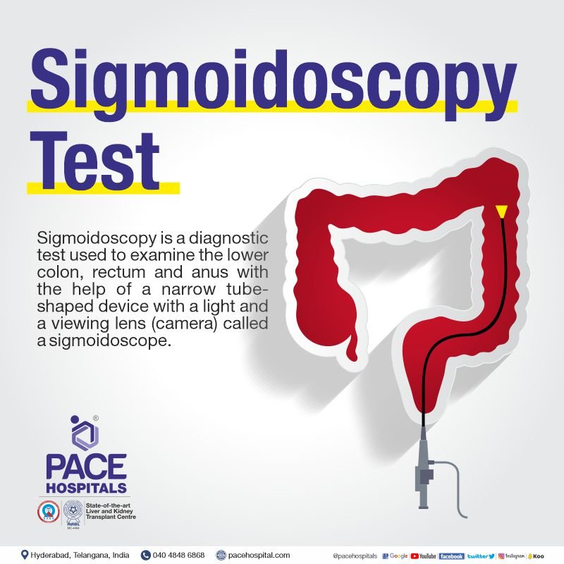 Sigmoidoscopy Test in Hyderabad | Indications, Purpose, Effects & Cost