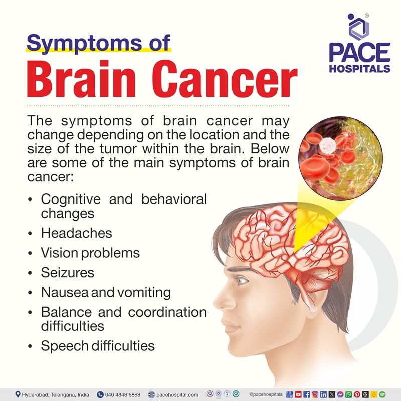 Brain cancer - Symptoms, Causes, Complications and Treatment
