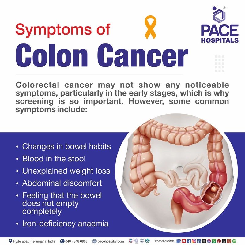 Colon Cancer: Types, Causes, Risk Factors, Symptoms & Treatment