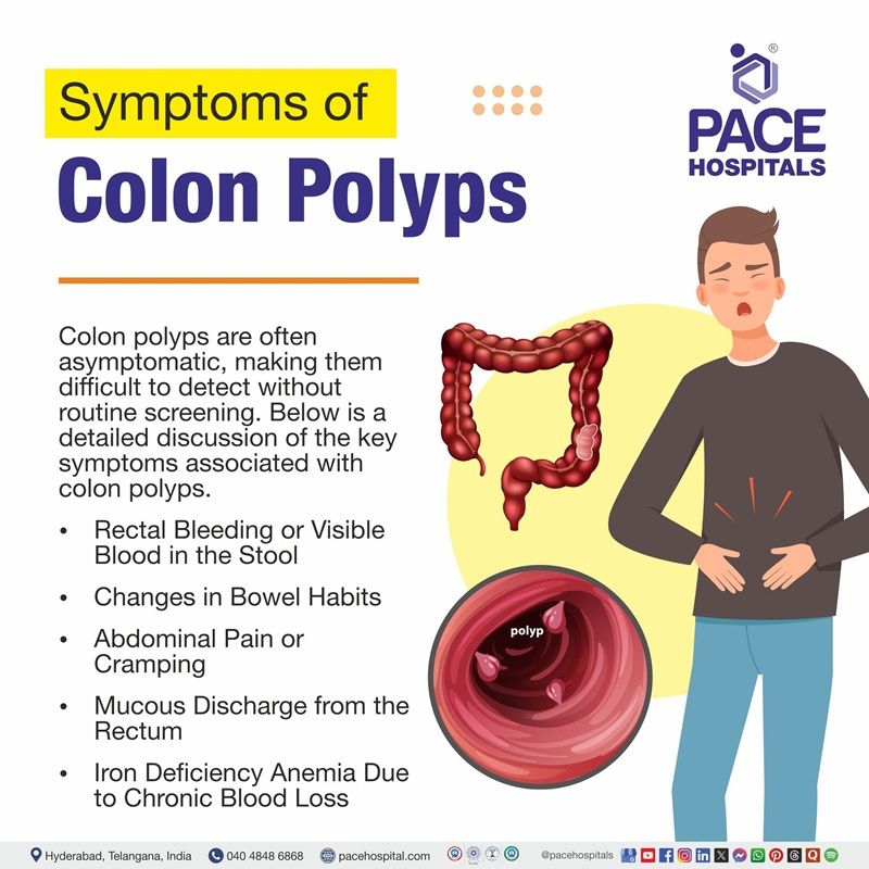 Colon Polyps: Symptoms, Causes, Types, Treatment & Prevention
