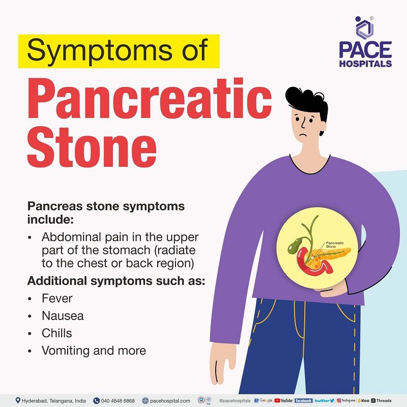 Pancreatic stones - Causes, Symptoms, Complications & Prevention