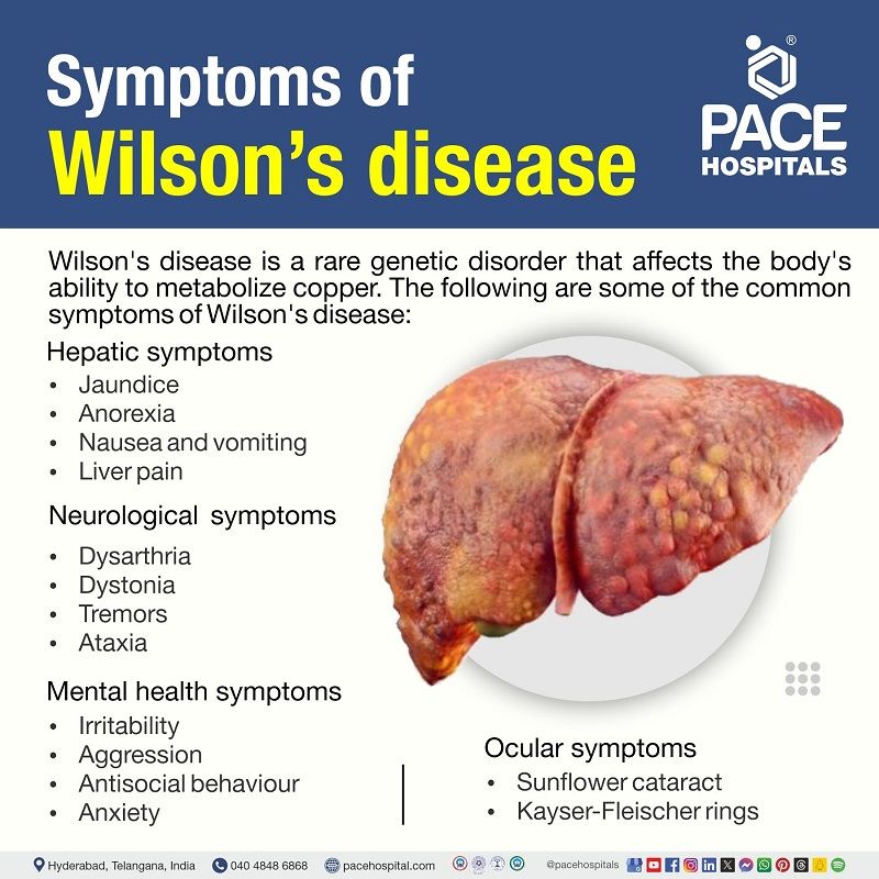 Wilson’s Disease - Symptoms, Causes, Prevention, and Treatment